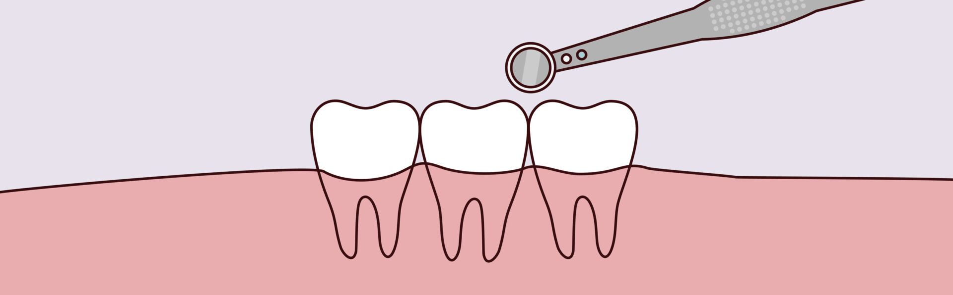 Oral Cancer Detection Using Trimira Identafi - The Hills Dental Associates